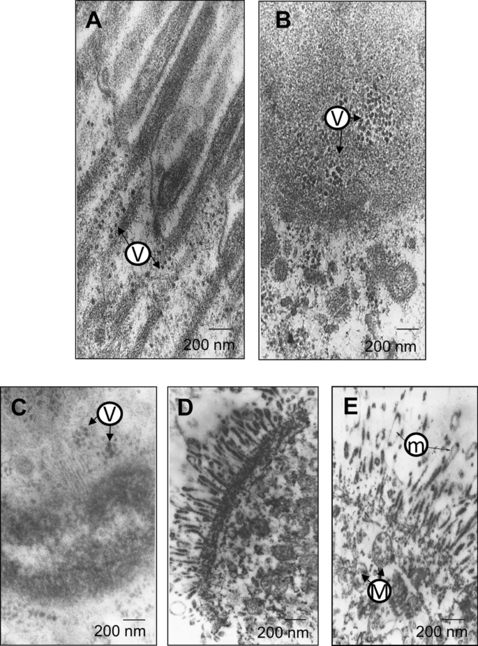 Molecular and ultrastructural characteristics of virulent and ...