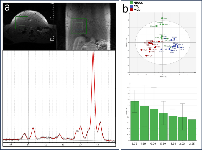 Characterization of Hepatic Steatosis in Alcoholic (NIAAA) and Non ...