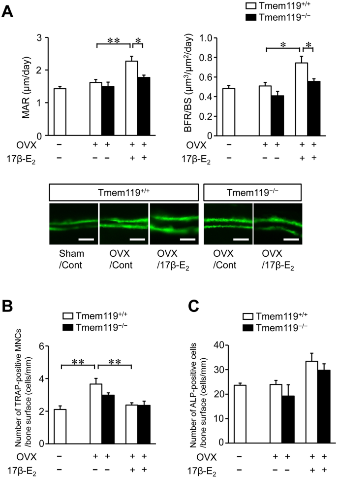 The role of Tmem119 in the estrogen action on bone in mice | Journal of ...