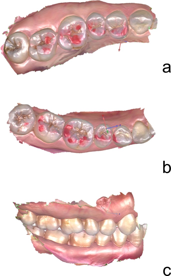 An innovative evaluation method for clinical comparative analysis of ...