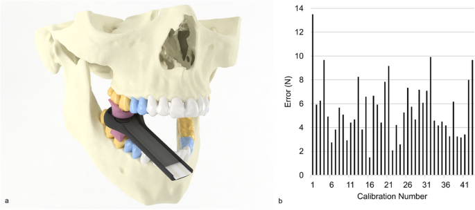 Predictive bite force modelling of head and neck oncology patients for ...
