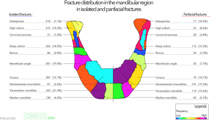 A comparison of isolated mandibular fractures and pattern of fractures ...