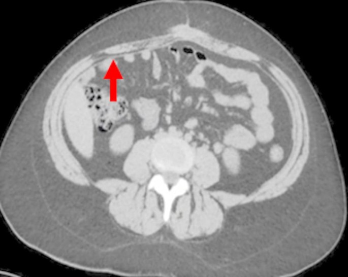 Evaluation of radiologists’ accuracy and interrater reliability when ...
