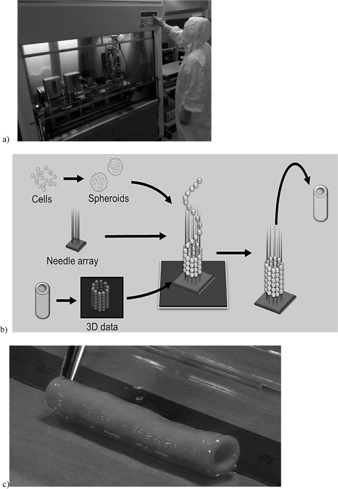 Artificial blood vessels-clinical development of TEVG | Journal of ...