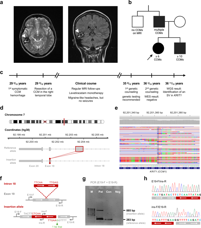 Familial cerebral cavernous malformations caused by a novel germline ...
