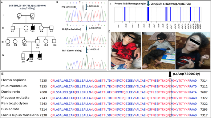 Rare autosomal recessive hereditary sensory and autonomic neuropathy ...