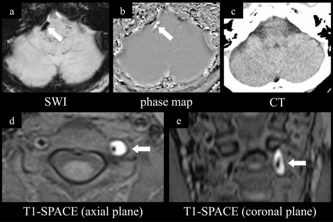 The essential role of multimodal magnetic resonance imaging in ...