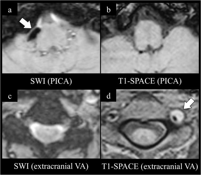 The essential role of multimodal magnetic resonance imaging in ...