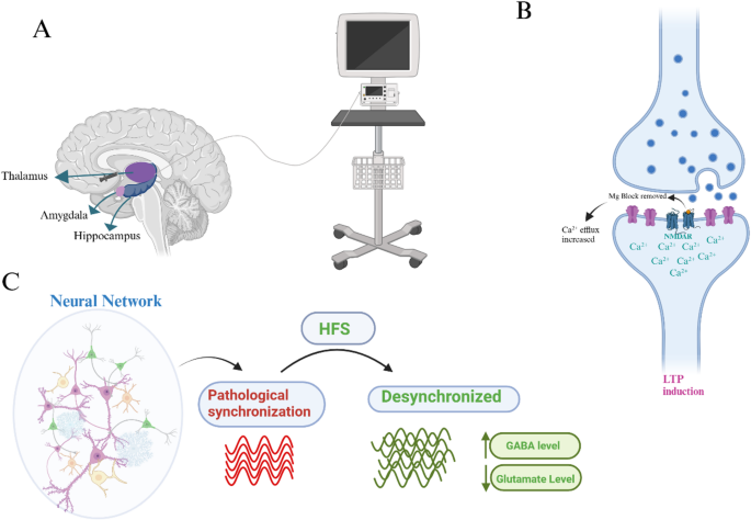 Bioelectric Modulation in Epilepsy: A Comparative Review of High ...