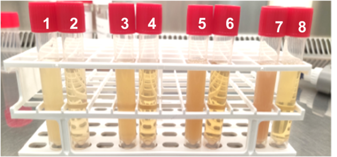 Diagnostic characteristics of the Rapid ESBL NP® test and ...