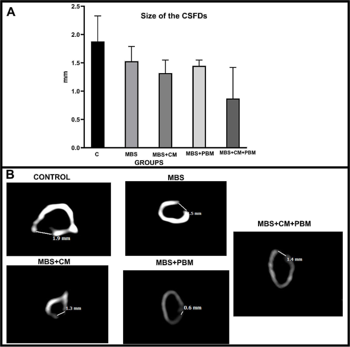 Photobiomodulation and mesenchymal stem cell-conditioned medium for the ...