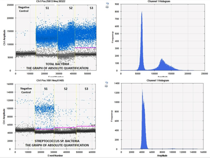 Is SWEEPS better than PUI in reducing intracanal bacteria and ...