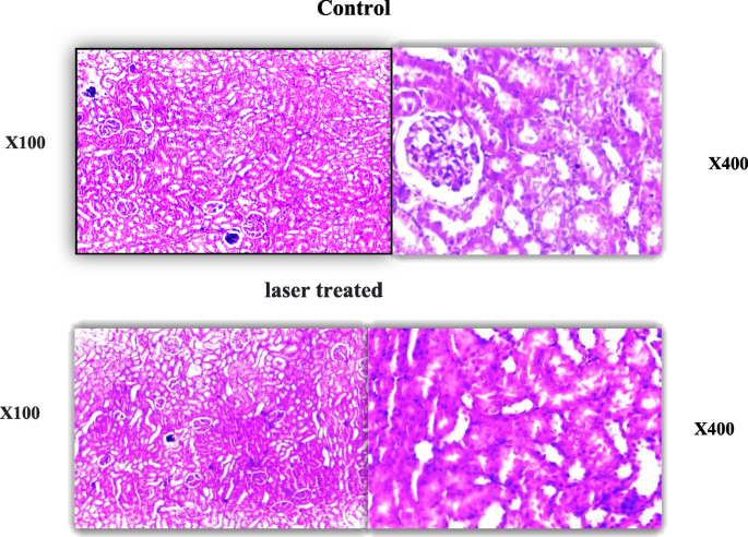 Histological effects of exposure to home hair removal laser radiation ...