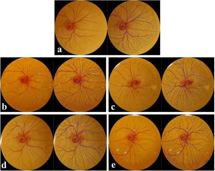 The effect of different time intervals of diode laser irradiation on ...