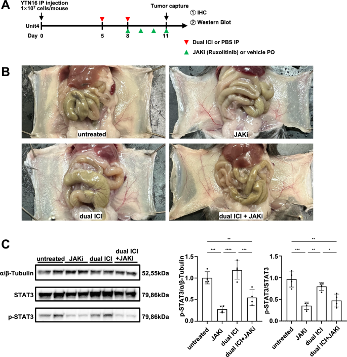 Janus kinase inhibitor overcomes resistance to immune checkpoint ...
