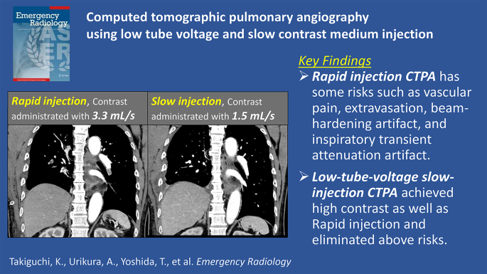 Computed tomographic pulmonary angiography using low tube voltage and ...
