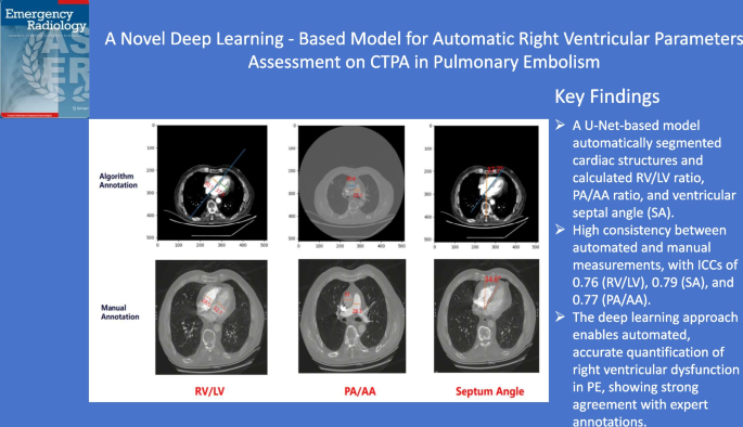 Developing a novel deep learning—based model for automatic right ...