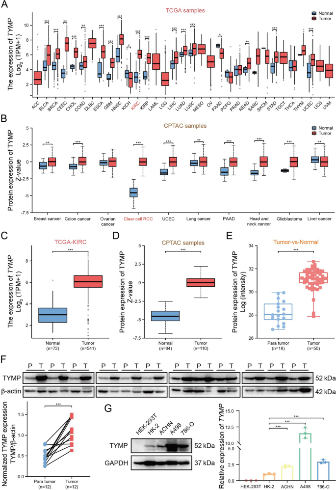 Transcription factor MAZ activates the transcription of hypomethylated ...