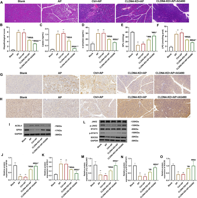 CLDN4 promotes ferroptosis and inflammation involving JAK2/STAT3 ...