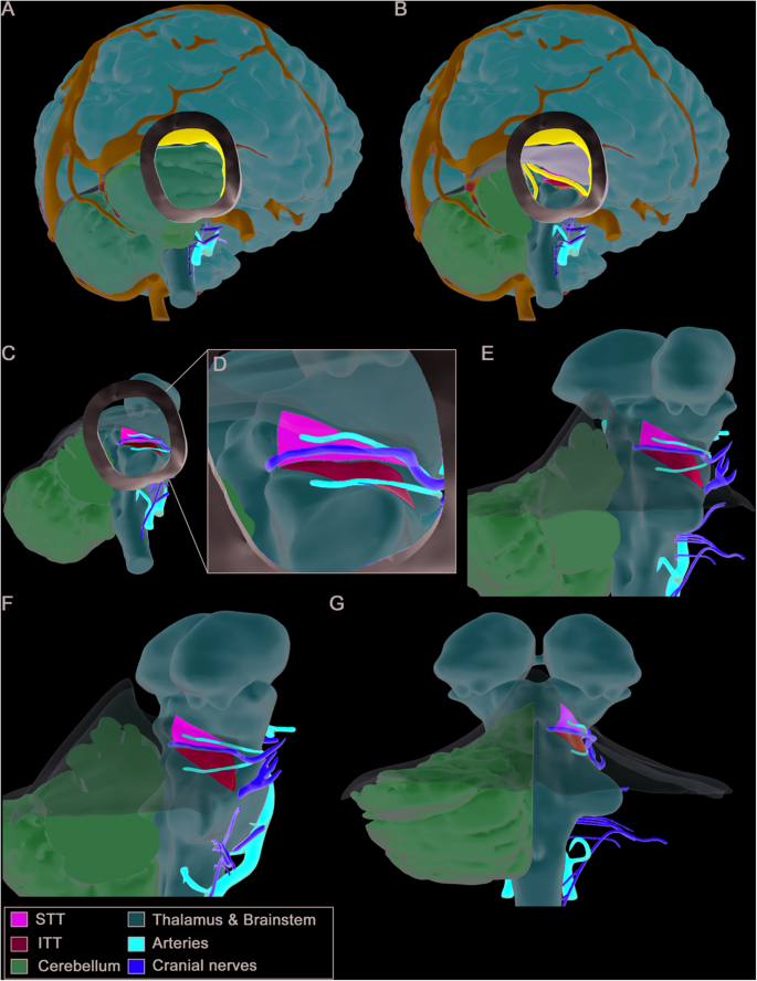 Correction to: Supracerebellar-supratrochlear and supracerebellar ...