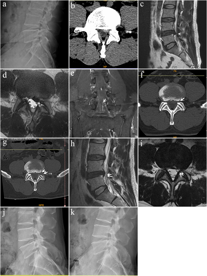 The value of contrast-enhanced MRI in the selection of surgical ...