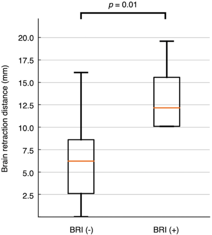 Risk assessment of brain retraction injury based on quantitative ...