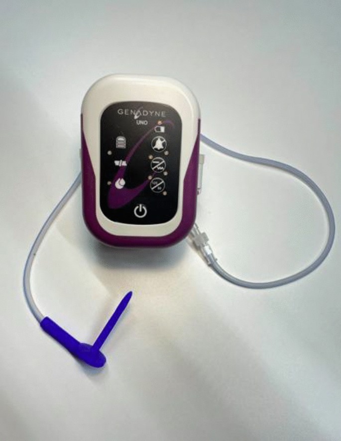 Semiflex-assisted vacuum therapy for perianal fistulas: the Semiflex ...