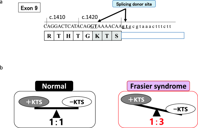 A review of the genetic background in complicated WT1-related disorders ...