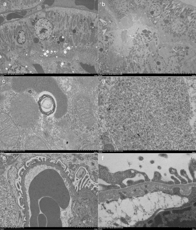 Red yeast rice supplement containing silica nanoparticles induces renal ...