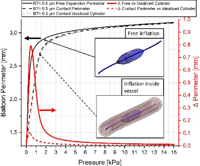 Correction: Finite element analysis of the interaction between high ...