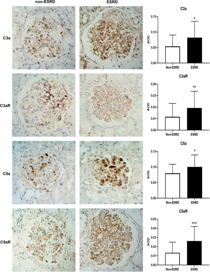 Complement C3a/C3aR and C5a/C5aR deposits accelerate the progression of ...