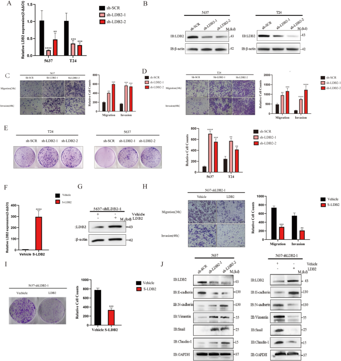 LDB2 is a novel diagnostic and prognostic biomarker and inhibits bladder cancer metastasis by ...