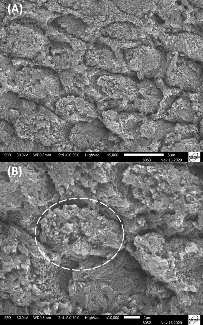 Effect of multi-layer applications of self-etch universal bonding ...