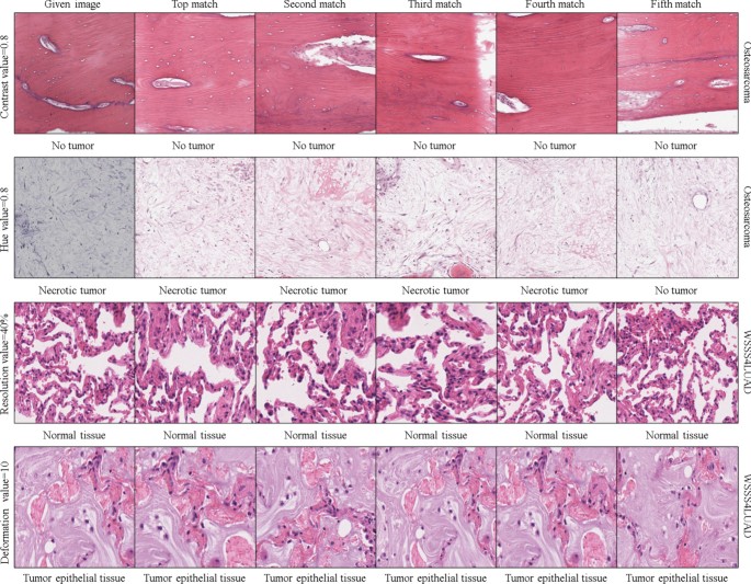 Benchmarking PathCLIP for Pathology Image Analysis | Journal of Imaging Informatics in Medicine