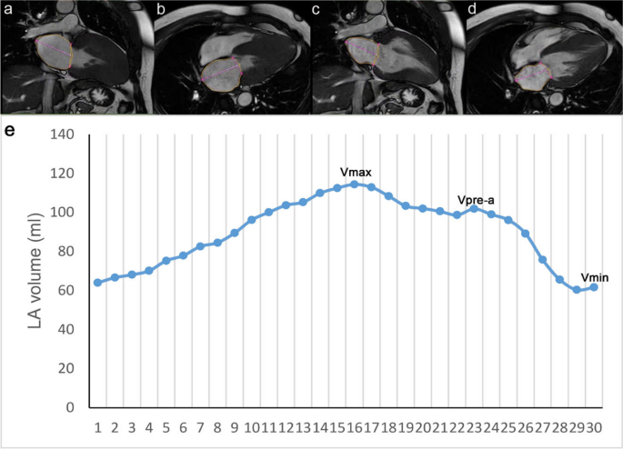Discrimination of Left Atrial Strain Patterns in Hypertensive Heart ...
