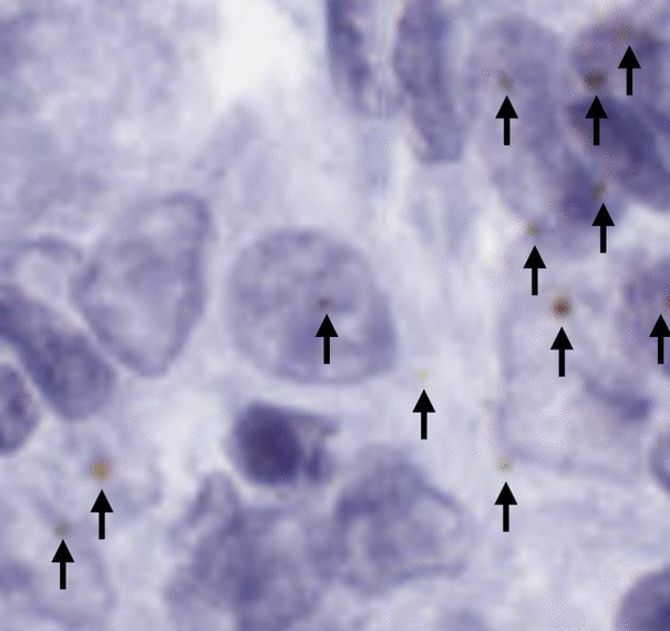 Deep Learning Segmentation of Chromogenic Dye RNAscope From Breast ...