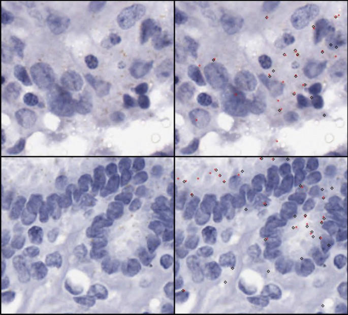 Deep Learning Segmentation of Chromogenic Dye RNAscope From Breast ...