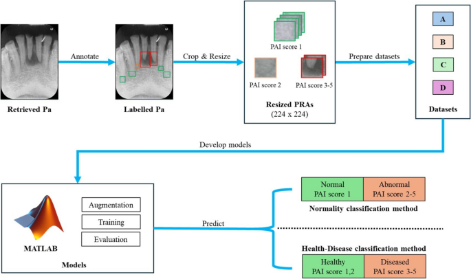 Development of Periapical Index Score Classification System in ...