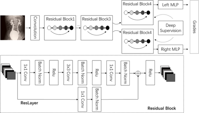Automated Grading of Vesicoureteral Reflux (VUR) Using a Dual-Stream CNN Model with Deep ...