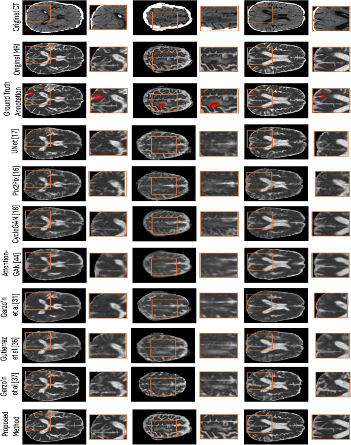 Mask-Guided and Fidelity-Constrained Deep Learning Model for Accurate ...