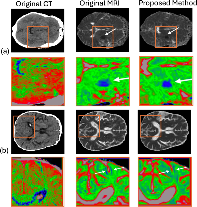 Mask-Guided and Fidelity-Constrained Deep Learning Model for Accurate ...