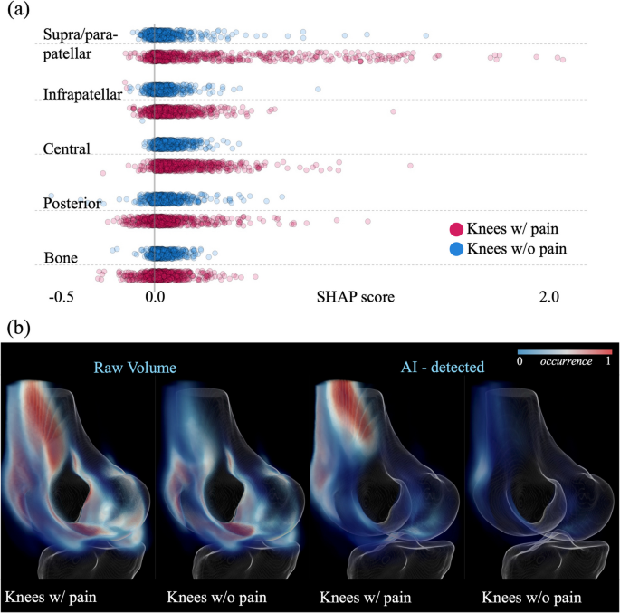 Localizing Knee Pain via Explainable Bayesian Generative Models and ...