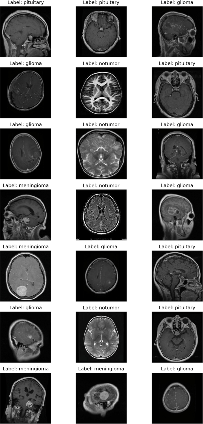 Lightweight Transfer Learning Models for Multi-Class Brain Tumor Classification: Glioma ...