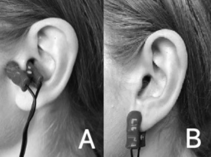 Influence of a 2-week transcutaneous auricular vagus nerve stimulation ...