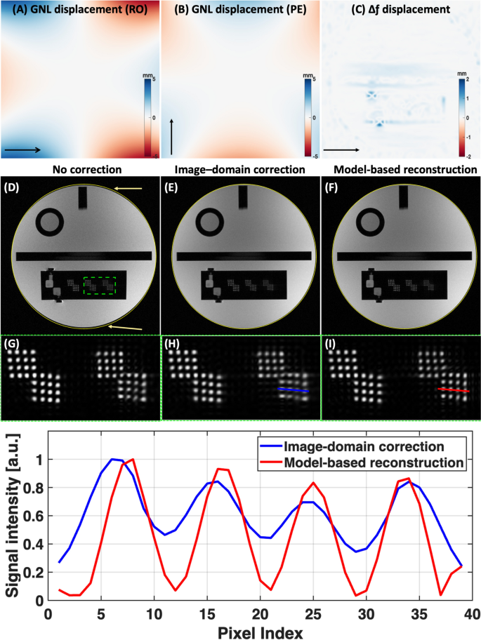 Distortion correction in TSE near titanium implants at 0.55 T using ...