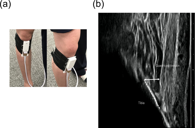 Restricted morphological changes in infrapatellar fat pad during ...