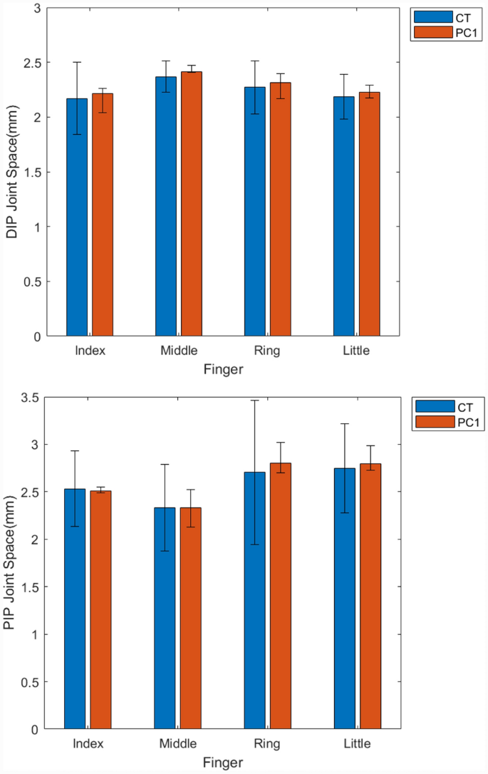 OpenHands: An Open-Source Statistical Shape Model of the Finger Bones ...