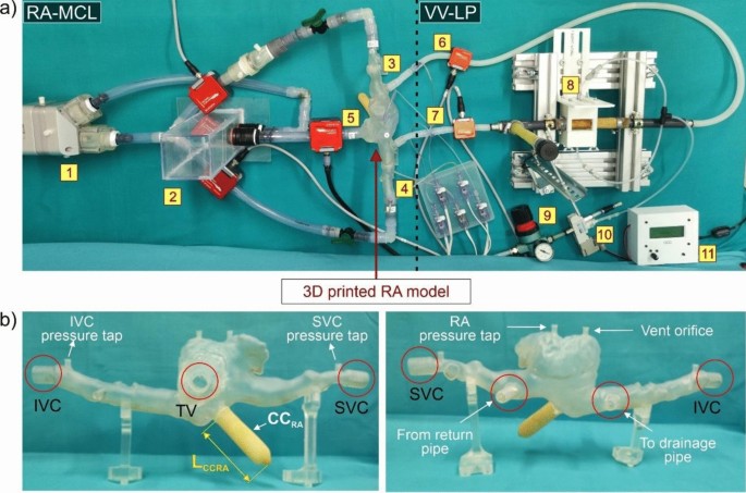 A Novel Valveless Pulsatile Flow Pump for Extracorporeal Blood ...
