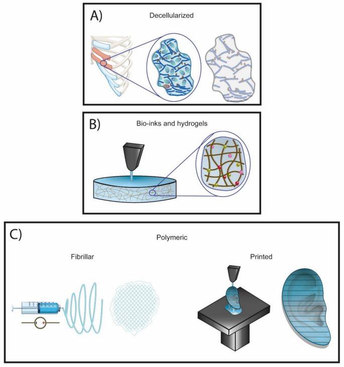 Innovative Approaches in Microtia Treatment: Advancements in Tissue ...