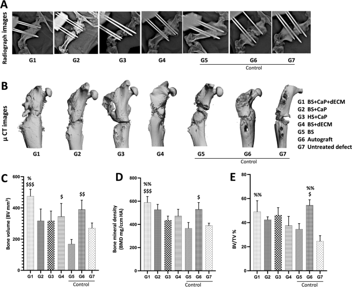 Growth Factor-Free Engineered Biphasic Scaffold for Enhanced Bone ...